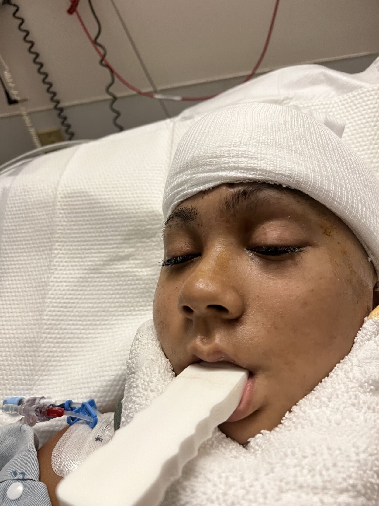 Richianna DeGuzman, teen shot in head, has successful brain surgery ...