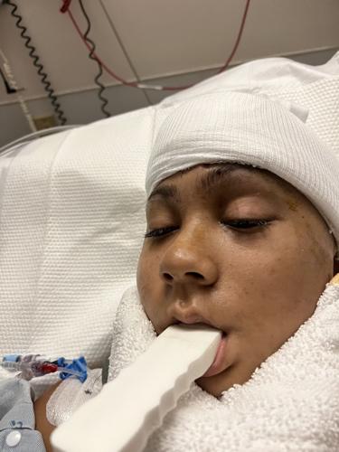 Richianna DeGuzman, teen shot in head, has successful brain surgery ...