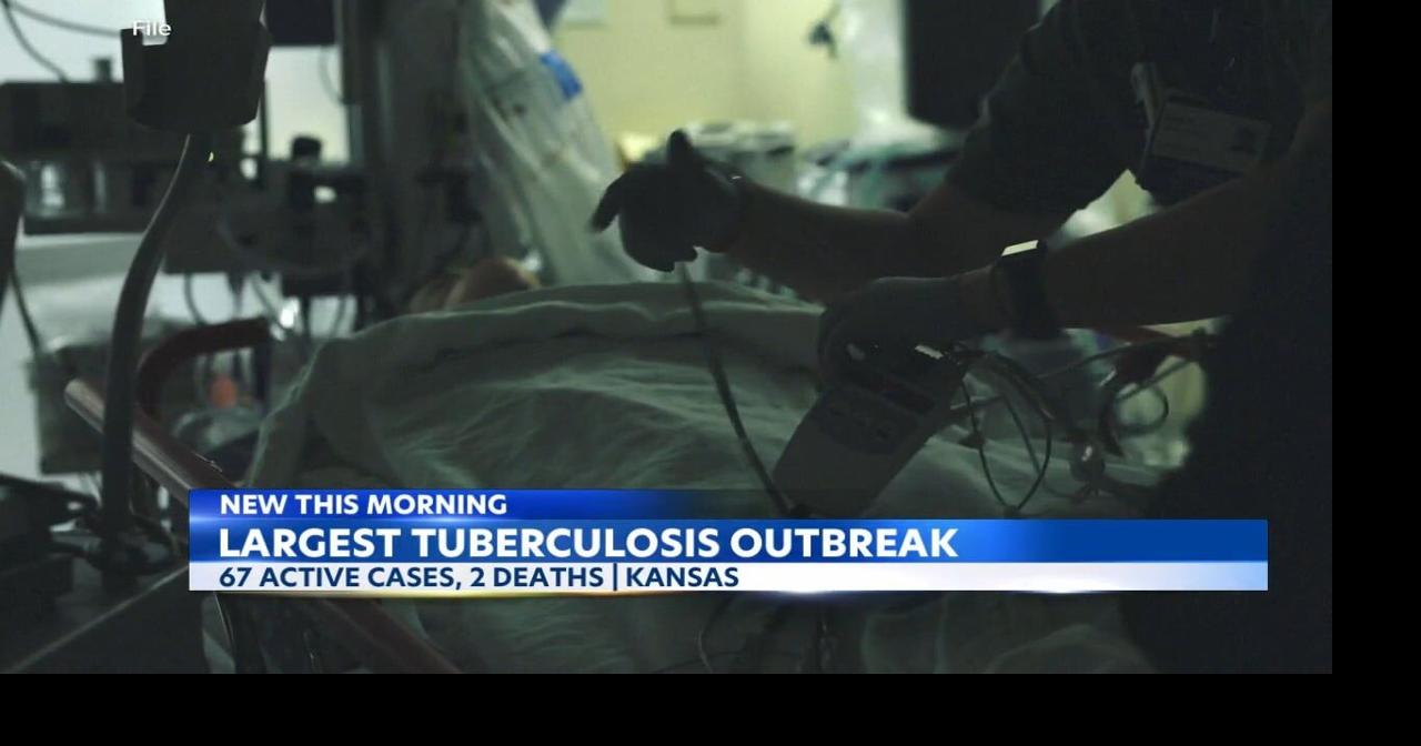 Kansas TB outbreak and Bird Flu raise health communication concerns ...