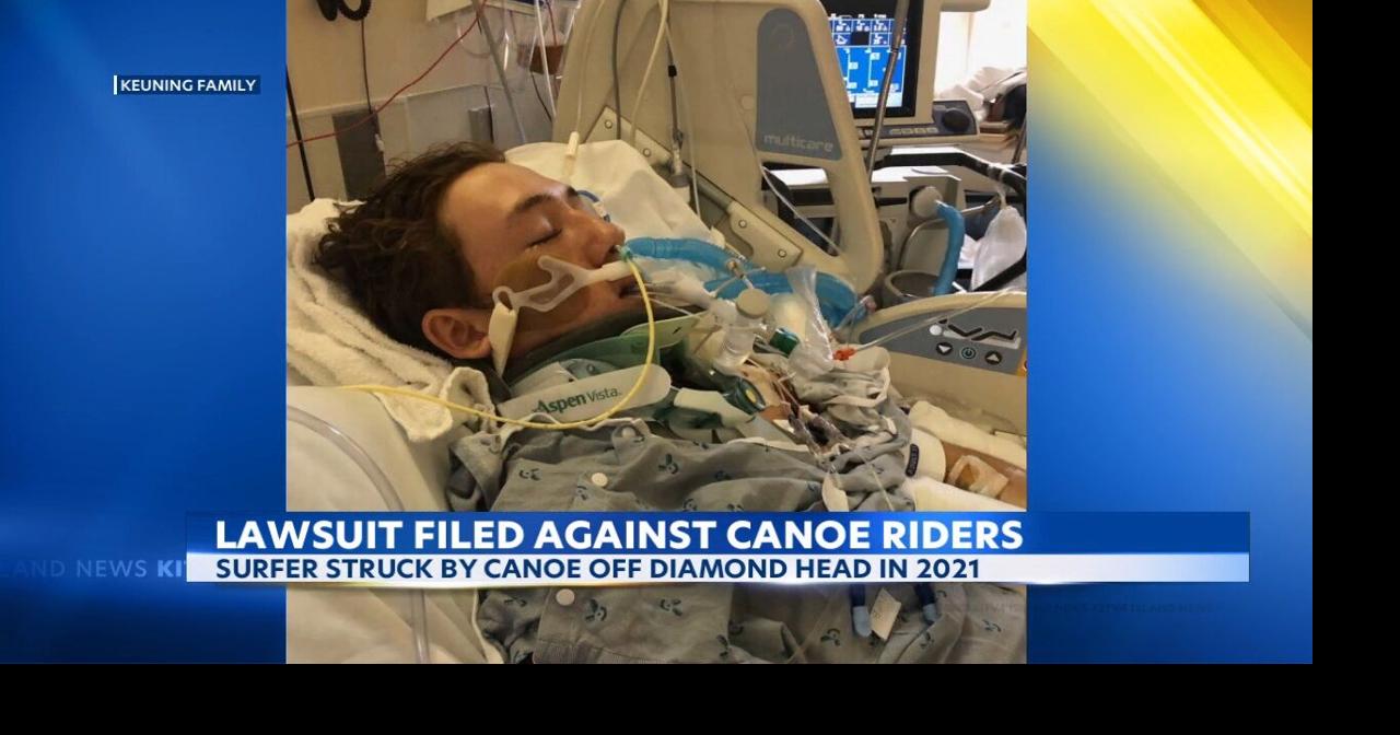 Teen surfer sues three paddlers, after canoe accident causes brain ...