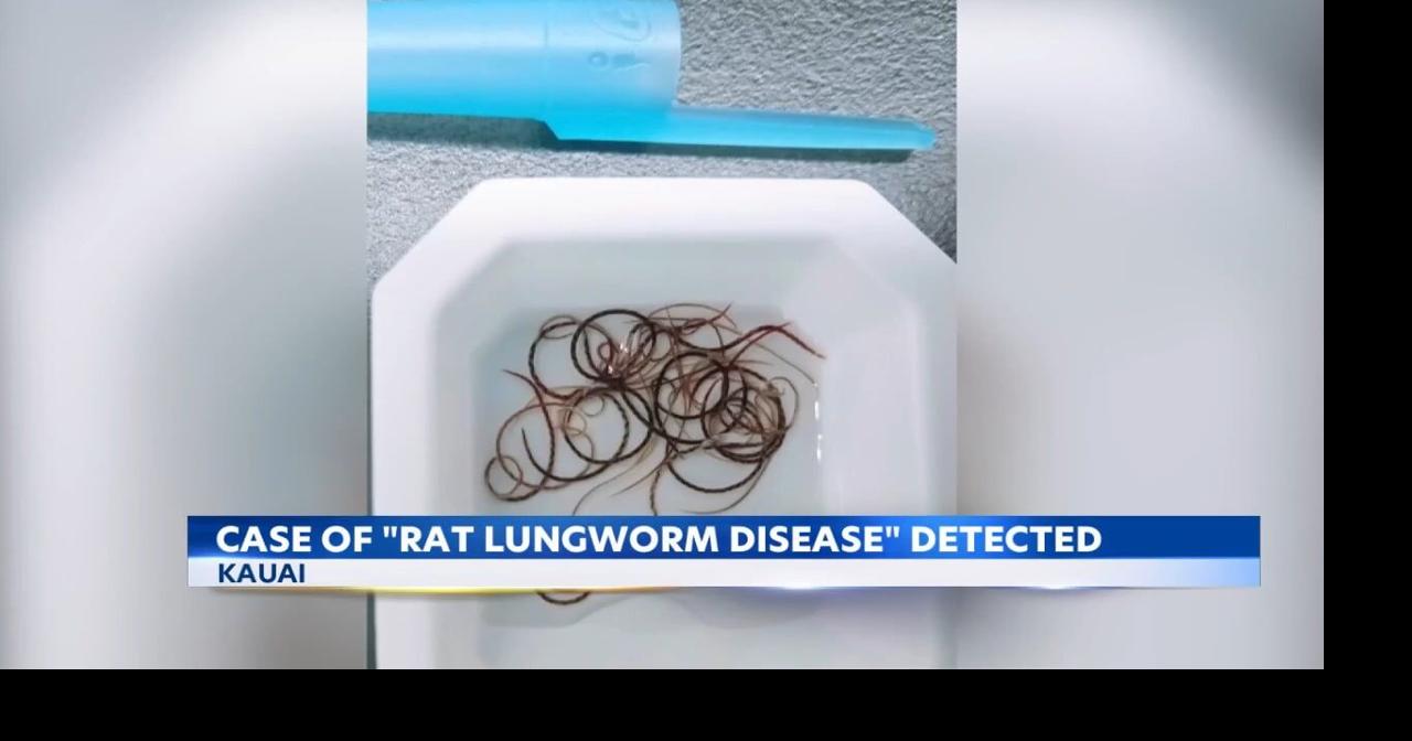 Health alert in Kauai after new rat lungworm disease case | Local ...