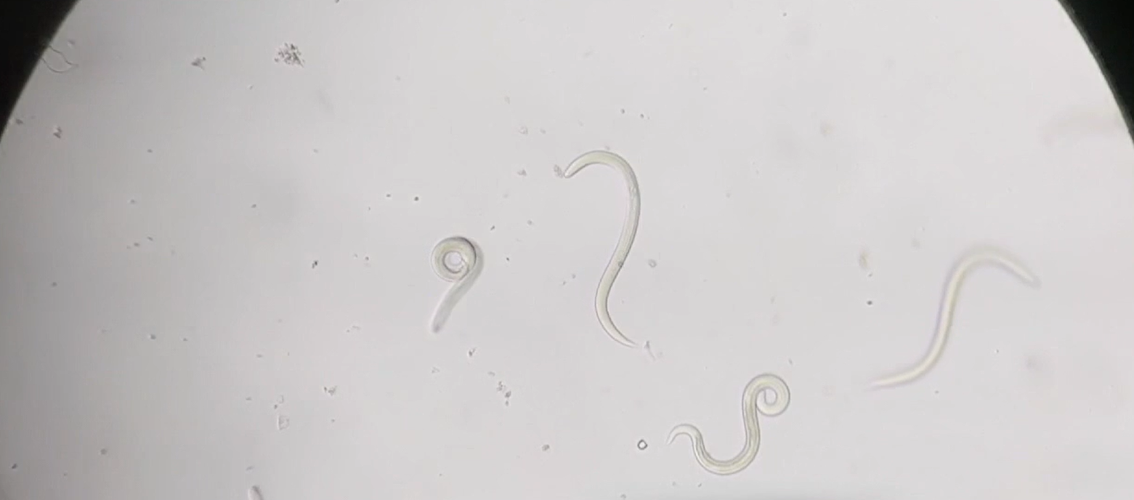 Health alert in Kauai after new rat lungworm disease case | Local | kitv.com