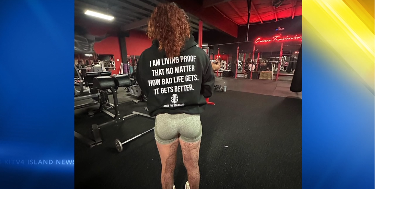 Mililani acid attack victim Davina Licon is back in the gym, with new ...