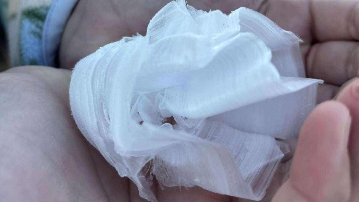 clear mucus plug 34 weeks