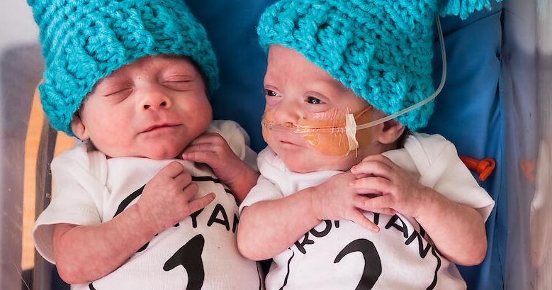 PHOTOS: NICU babies dress up in Halloween costumes at MU Health Care ...