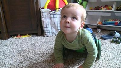 spina bifida mobility