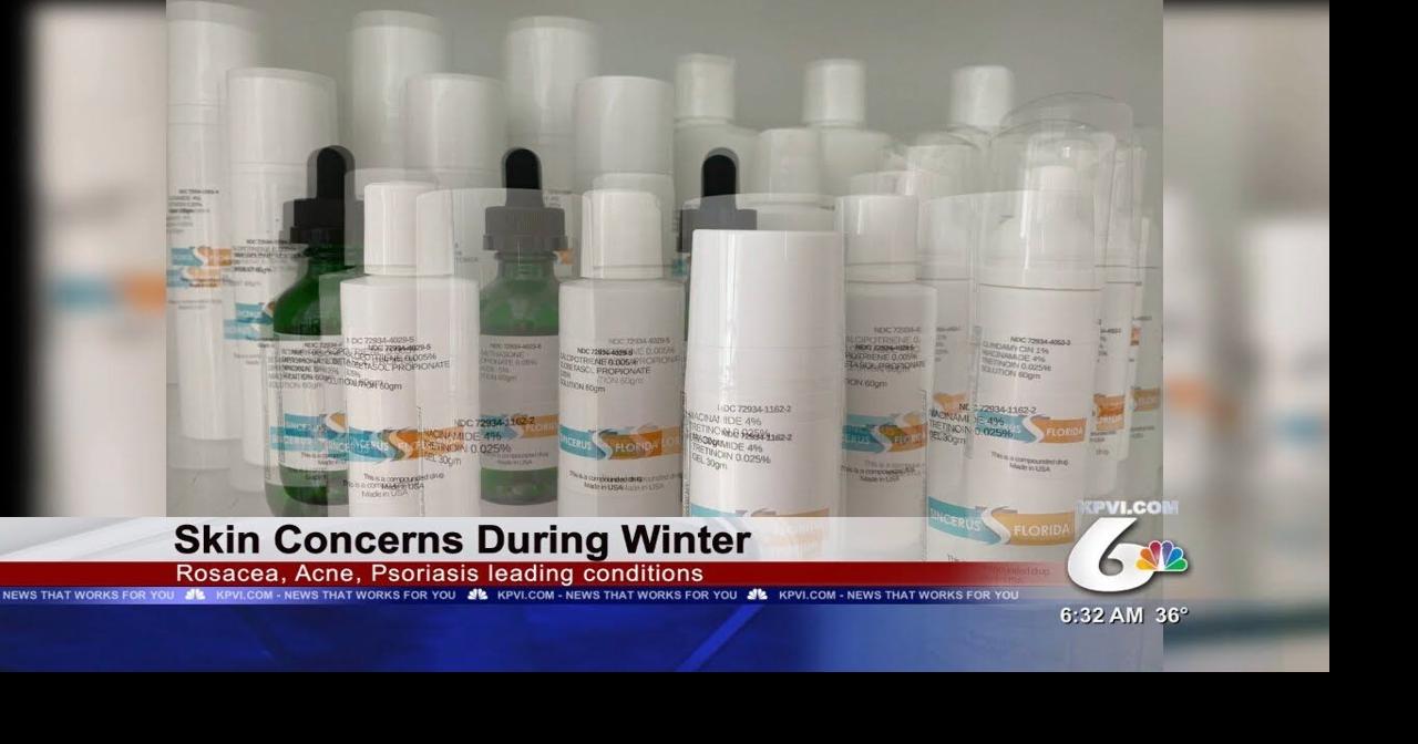 If you're dealing with these skin conditions during winter, this is ...