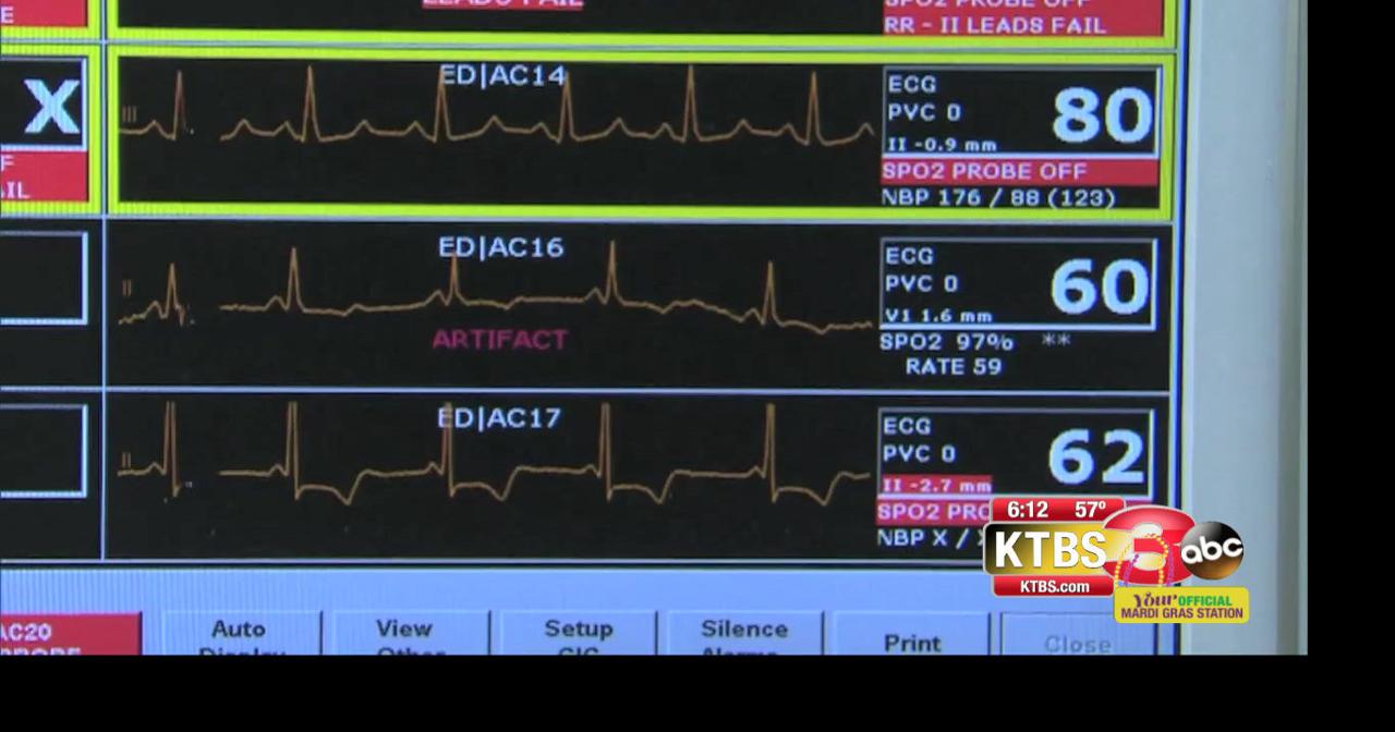 The Watchman device is game changer for patients with heart disease ...