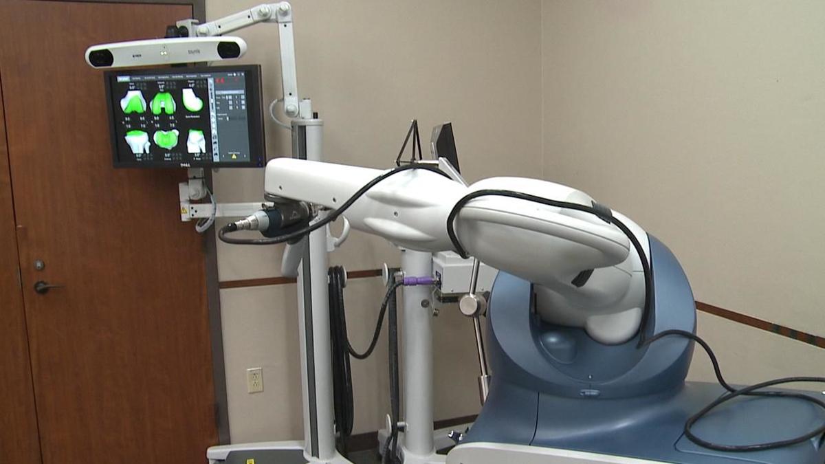 Robotic-arm assisting on knee replacement surgery | Texarkana | ktbs.com