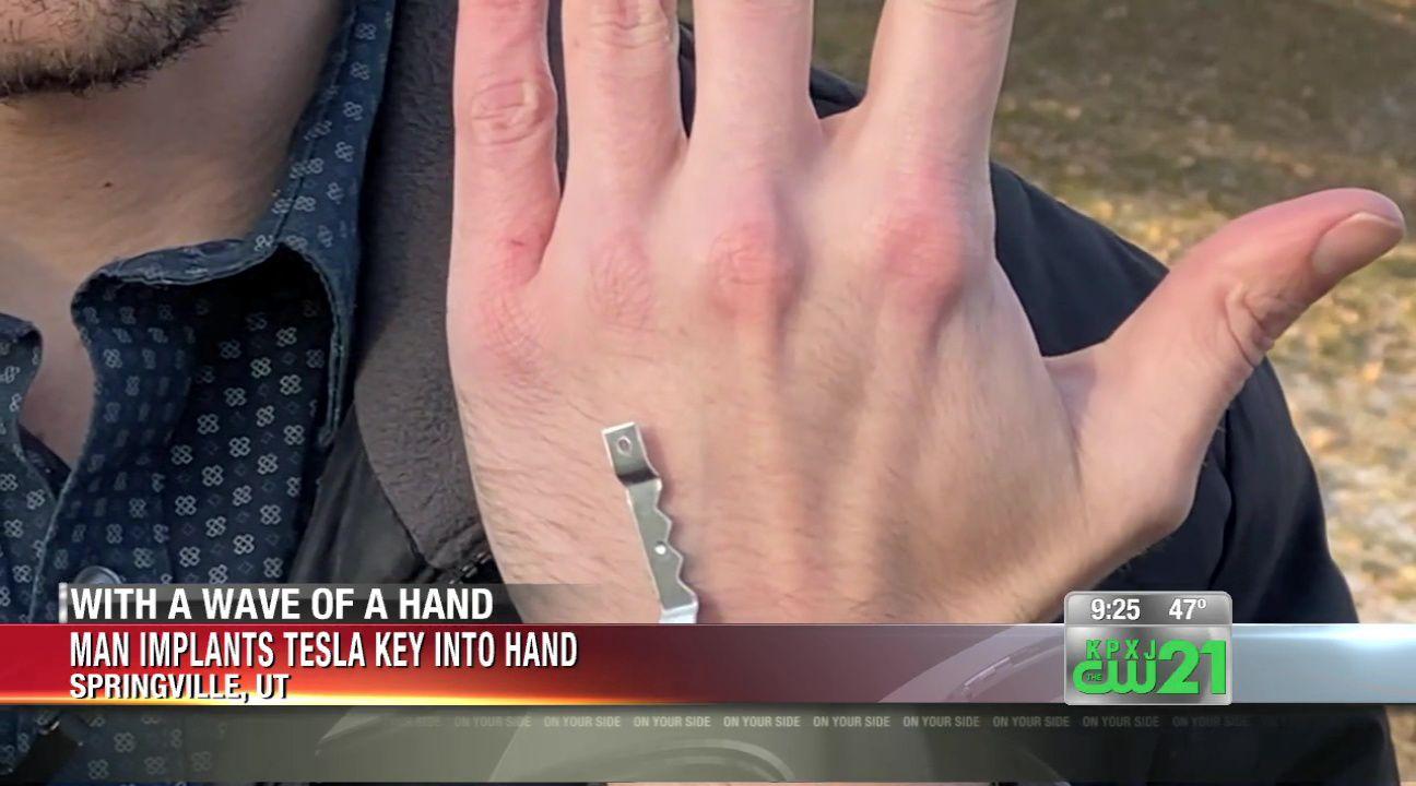 Man implants Tesla key into hand | Local News | ktbs.com