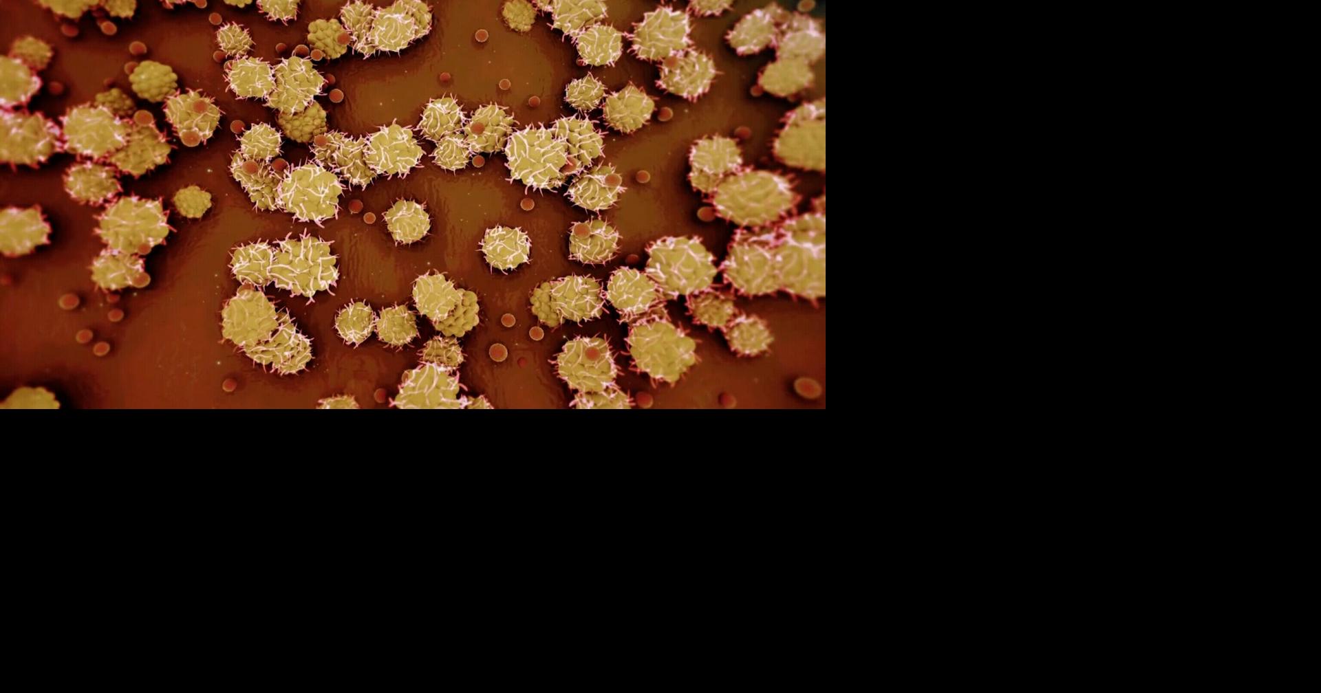 Why calling monkeypox an STD is about more than just a label | Health ...
