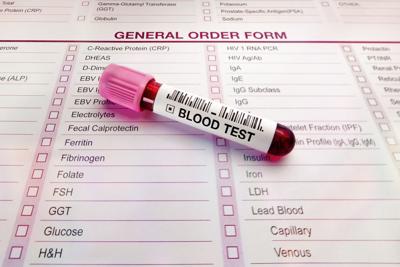 Blood test may help guide colorectal cancer treatment | Colorectal ...