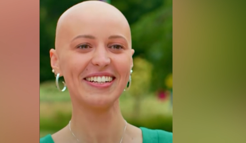 ‘Great British Baking Show’ star's platform highlights alopecia ...