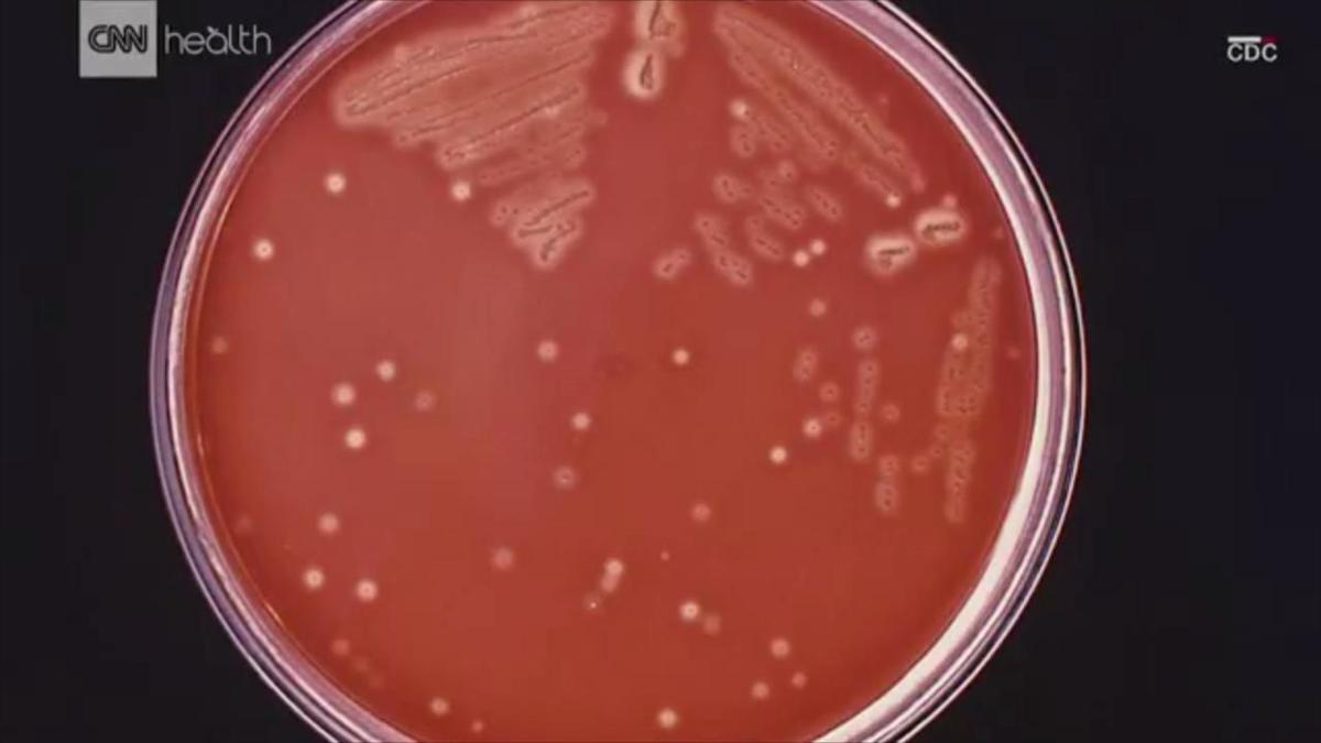 Flesh-eating bacteria not only found in water | Texarkana | ktbs.com