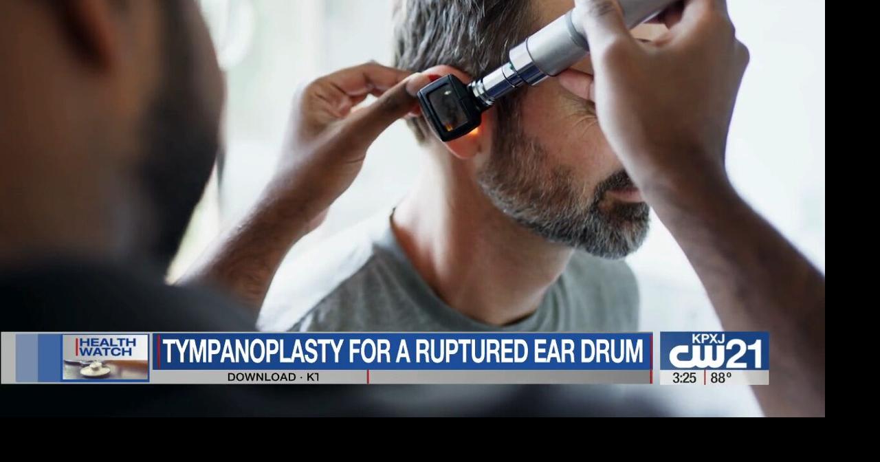 Modern advances in tympanoplasty: How surgeons repair a perforated ...