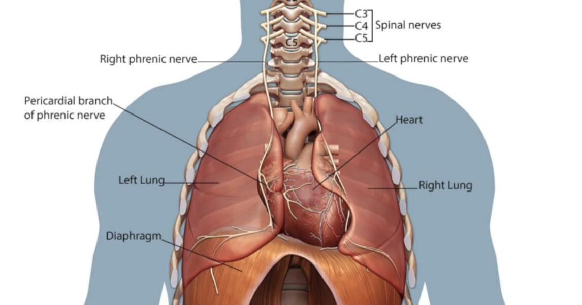 Local doctor performs first phrenic nerve stimulation procedure in ...