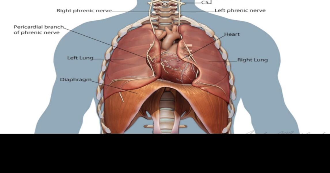 Local doctor performs first phrenic nerve stimulation procedure in ...