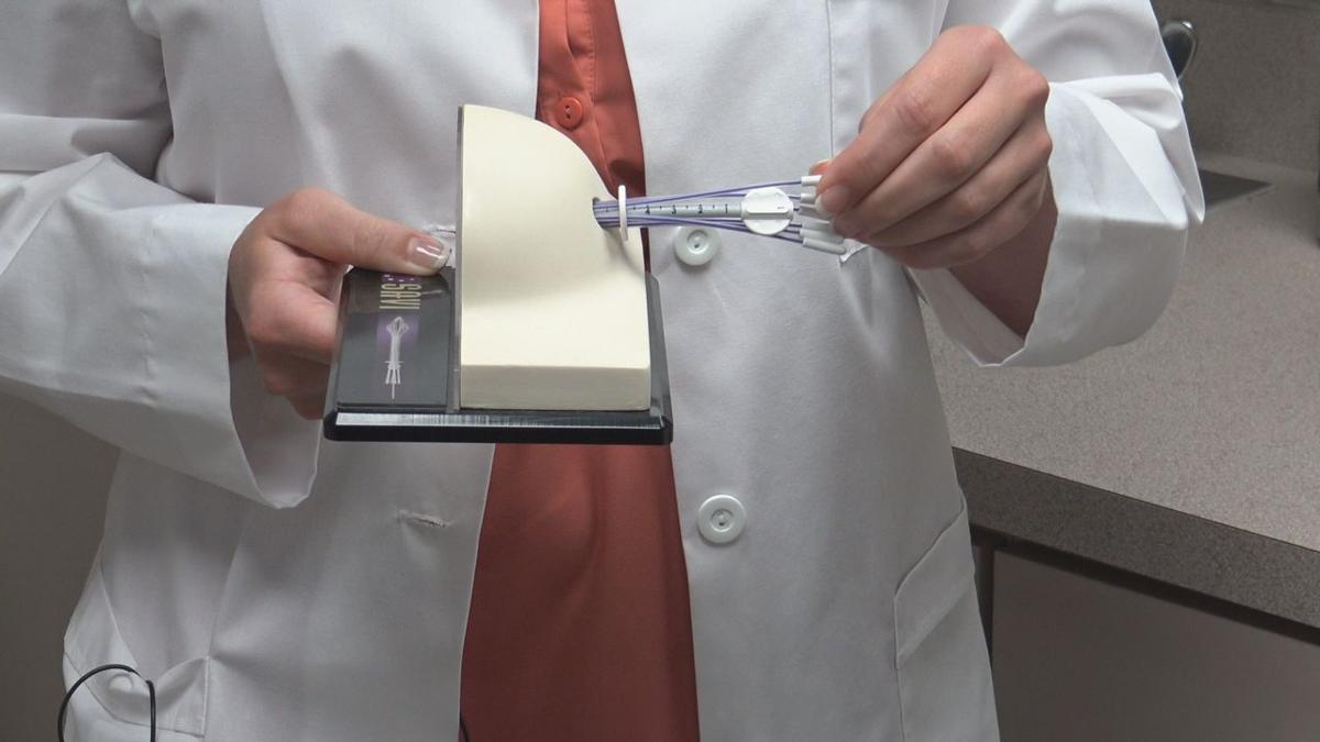 Savi Brachytherapy revolutionizes breast cancer surgery | ArkLaTex In ...