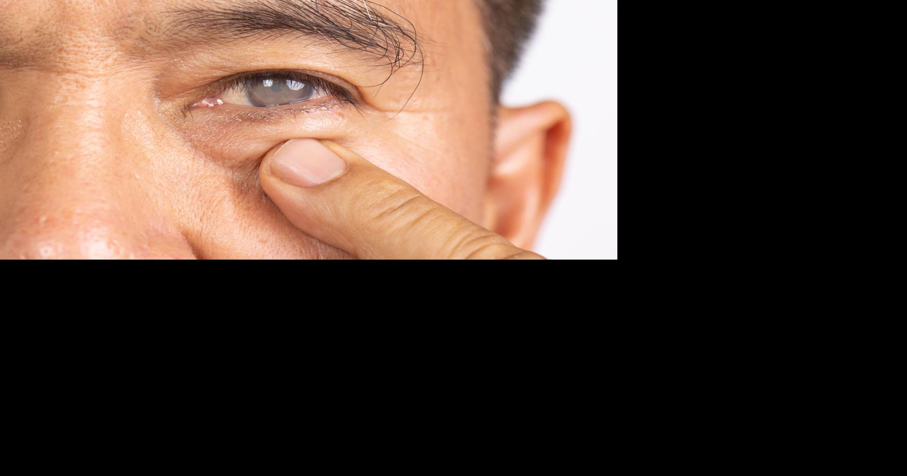 Eye insight during Cataract Awareness Month | Cataract Awareness Month ...