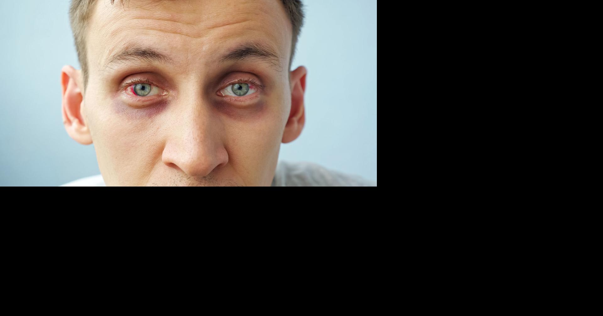 Blindness and vision impairment | Cataract Awareness Month | ktbs.com