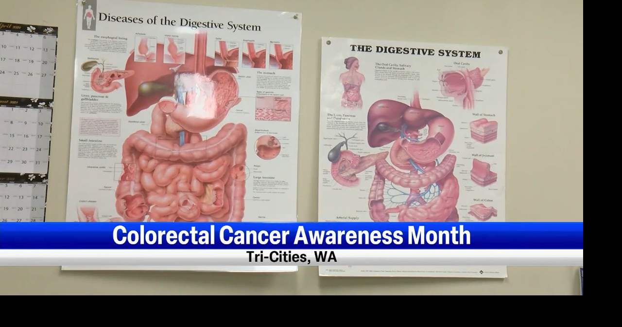 When should you be scheduling your next colonoscopy? | Billings News ...