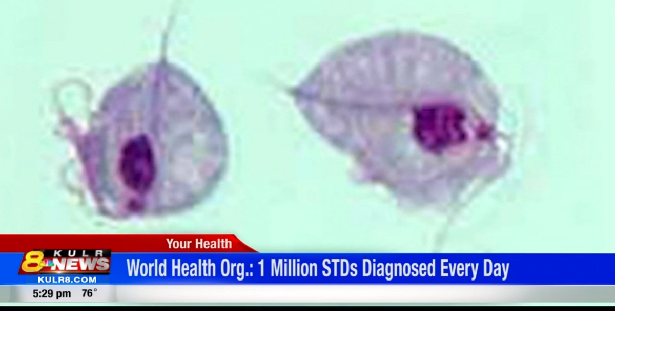 Your health: 1 million STDs diagnosed every day | Billings News | kulr8.com