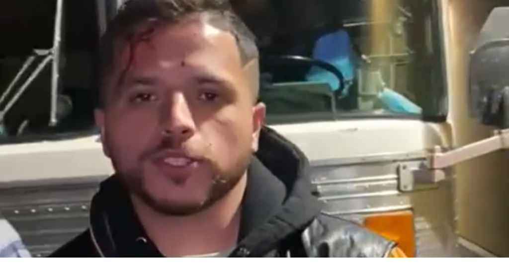 Mexican singer assaulted, robbed outside of nightclub before ...