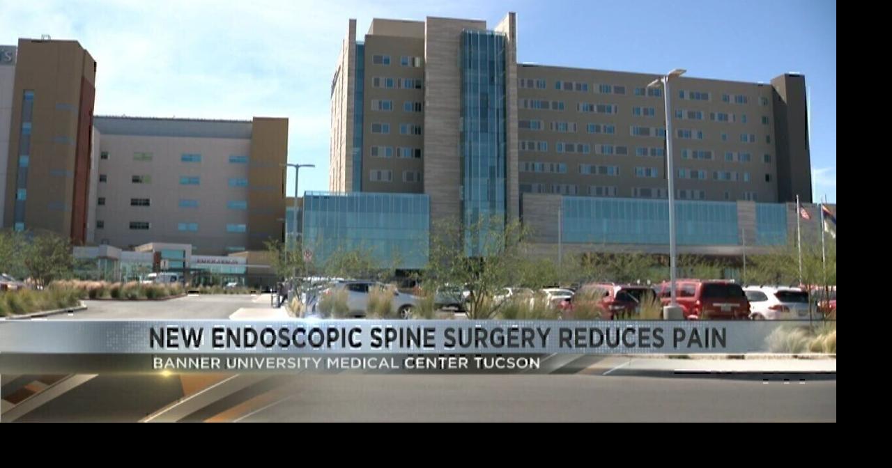 Banner UMC Tucson offers innovative spine surgery | News | kvoa.com