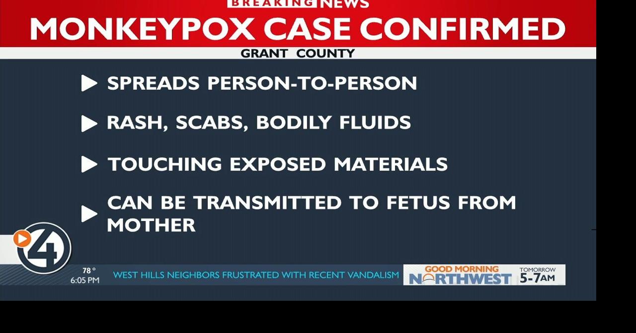 First case of monkeypox confirmed in Grant County | Local News | kxly.com