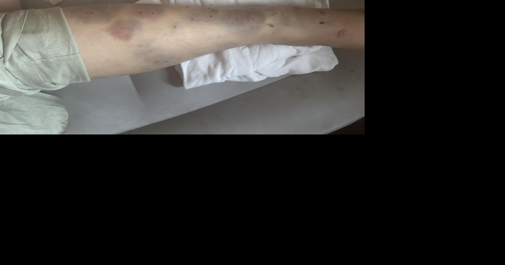 Wallace shooting victim shares recovery story as investigation ...