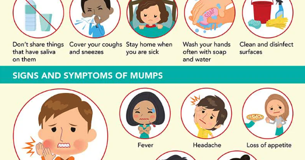 mumps symptoms in babies