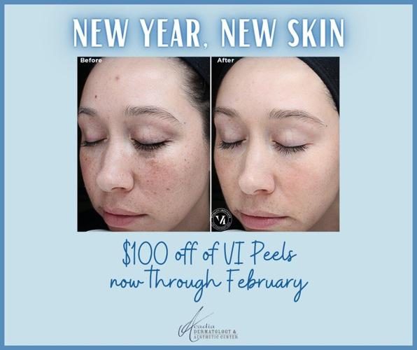 Acadia Dermatology is Nurturing Skin Health | Local News ...