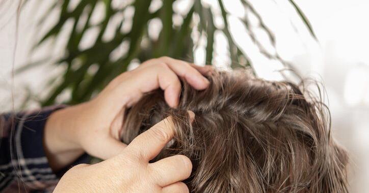 What Are Oat Lice? And How Are They Different from Head Lice? [Opinion ...