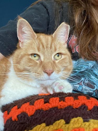 Lancaster burn victim maintains sense of humor despite hospitalization ...