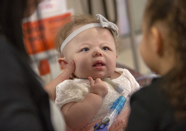 3D printing helps 13-month-old leave hospital for the first time in her ...