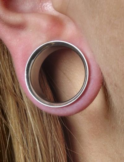 'Fixing' an ear gauge may require surgery | Lifestyle | lancasteronline.com