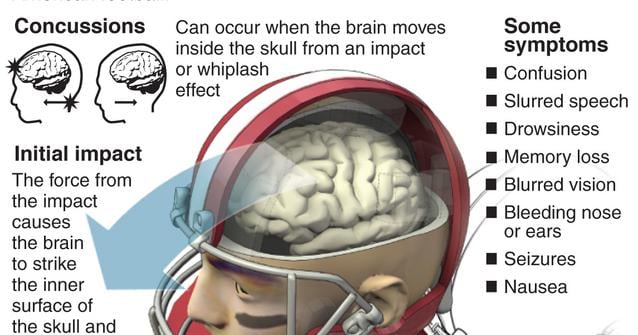 ‘Concussion’ & what you should know about sports and brain injuries ...