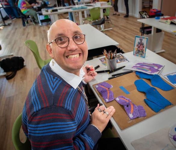 Friendship Heart artists paint clubfoot braces [photos ...