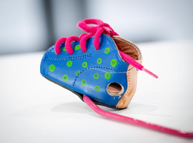 Friendship Heart artists paint clubfoot braces [photos ...