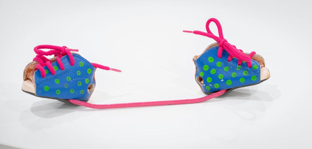 Friendship Heart artists paint clubfoot braces [photos ...