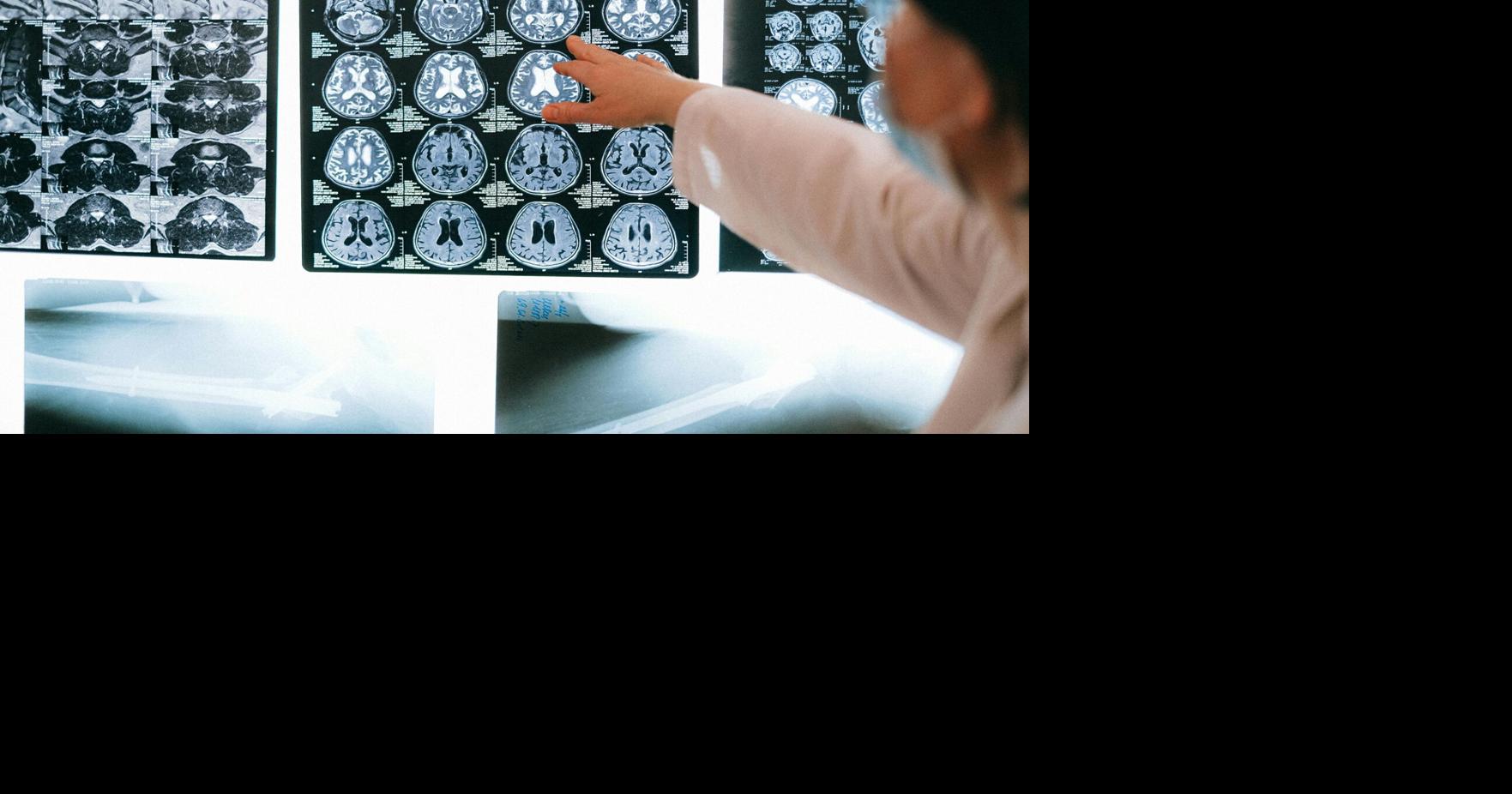 30 days to get medical imaging results? Here's what's happening in ...