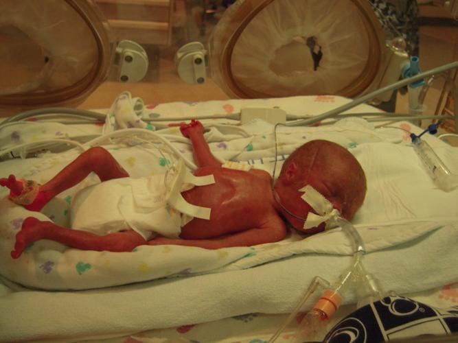 'Miracle' girl from Elizabethtown featured in Children's Miracle ...