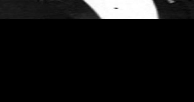 William "Billy" Stumpf | Obituaries | lancasteronline.com