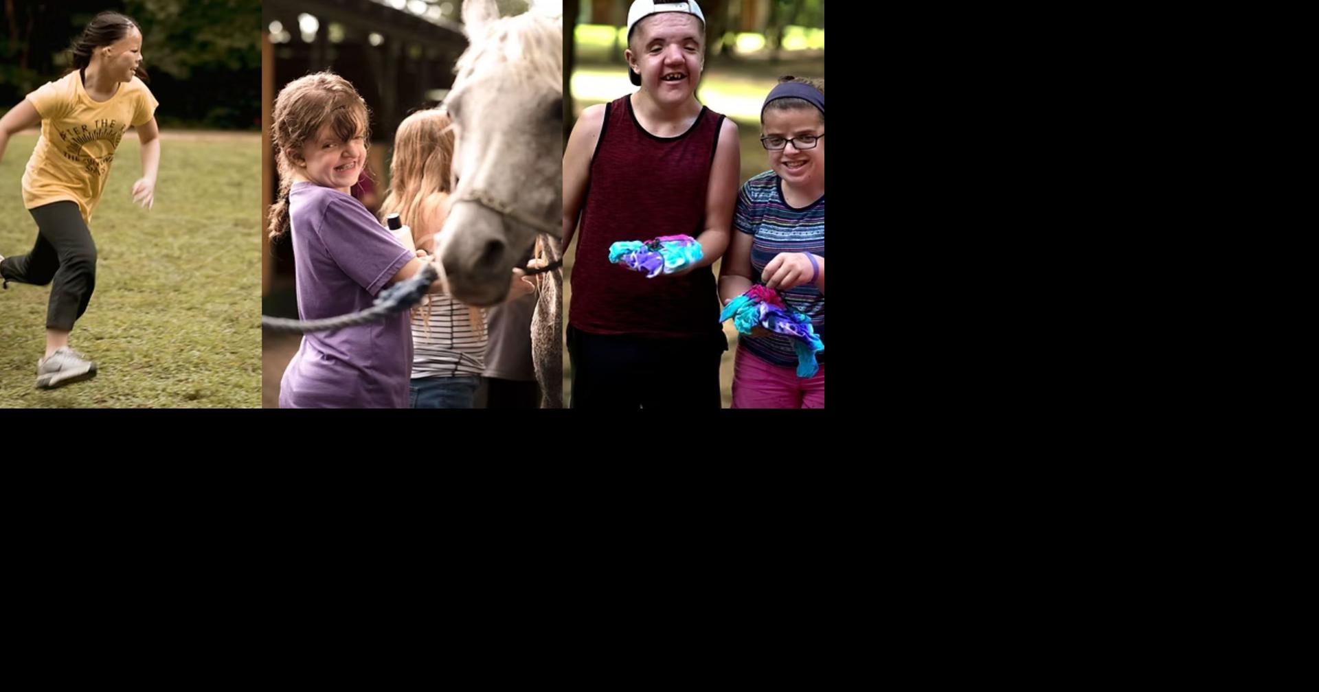 FACES Camp for Children with Craniofacial Differences | Local News ...