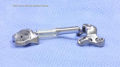 Hope for those with osteoarthritis in knees | Regional/National ...