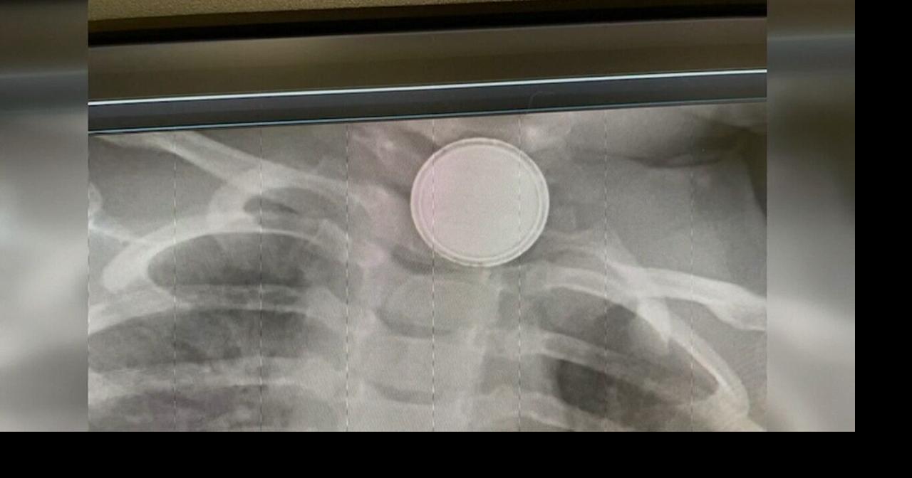 STUDY: More children are swallowing batteries which is dangerous ...