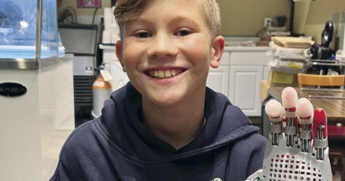 Los Altos teen helps build prosthetic hand for 11-year-old | Schools ...