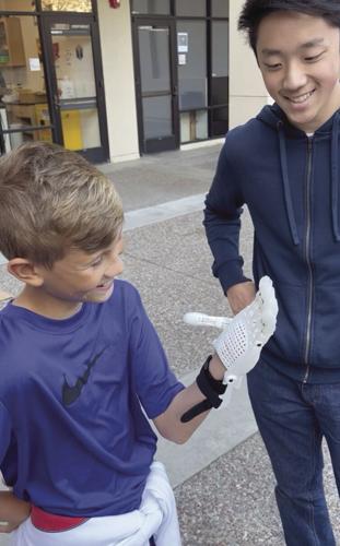 Los Altos teen helps build prosthetic hand for 11-year-old | Schools ...