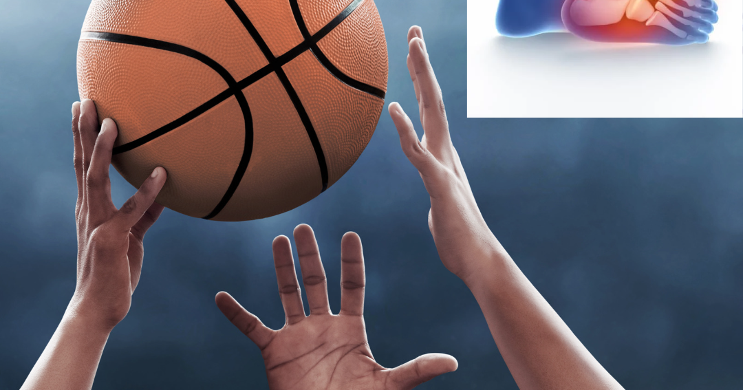 Ankle sprains: Not a trivial injury | News for to maximize your health ...