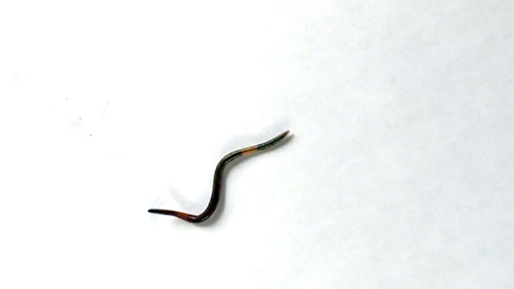 What Are Tiny Black Worms